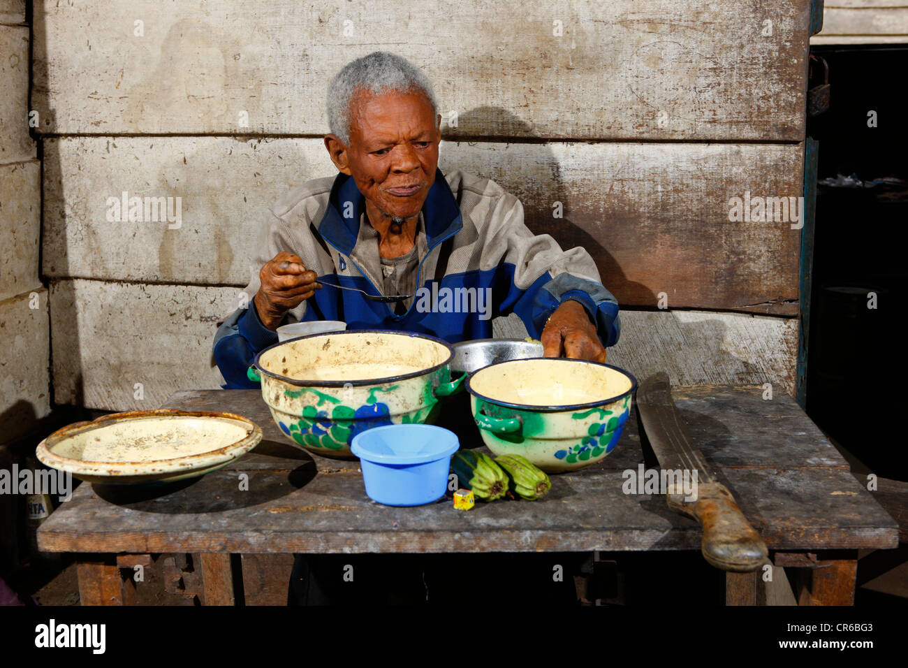 Leper eating food, TB and leprosy centre, Manyemen, Cameroon, Africa ...