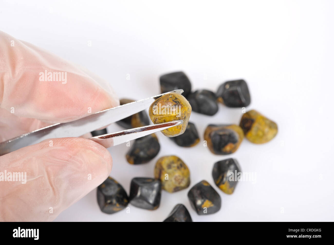 Gall stones hi-res stock photography and images - Alamy