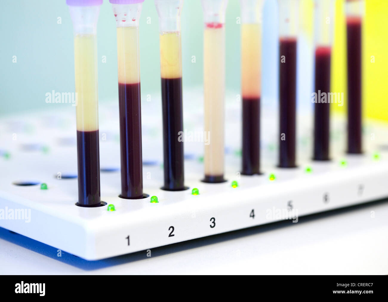 Blood research samples hi-res stock photography and images - Alamy