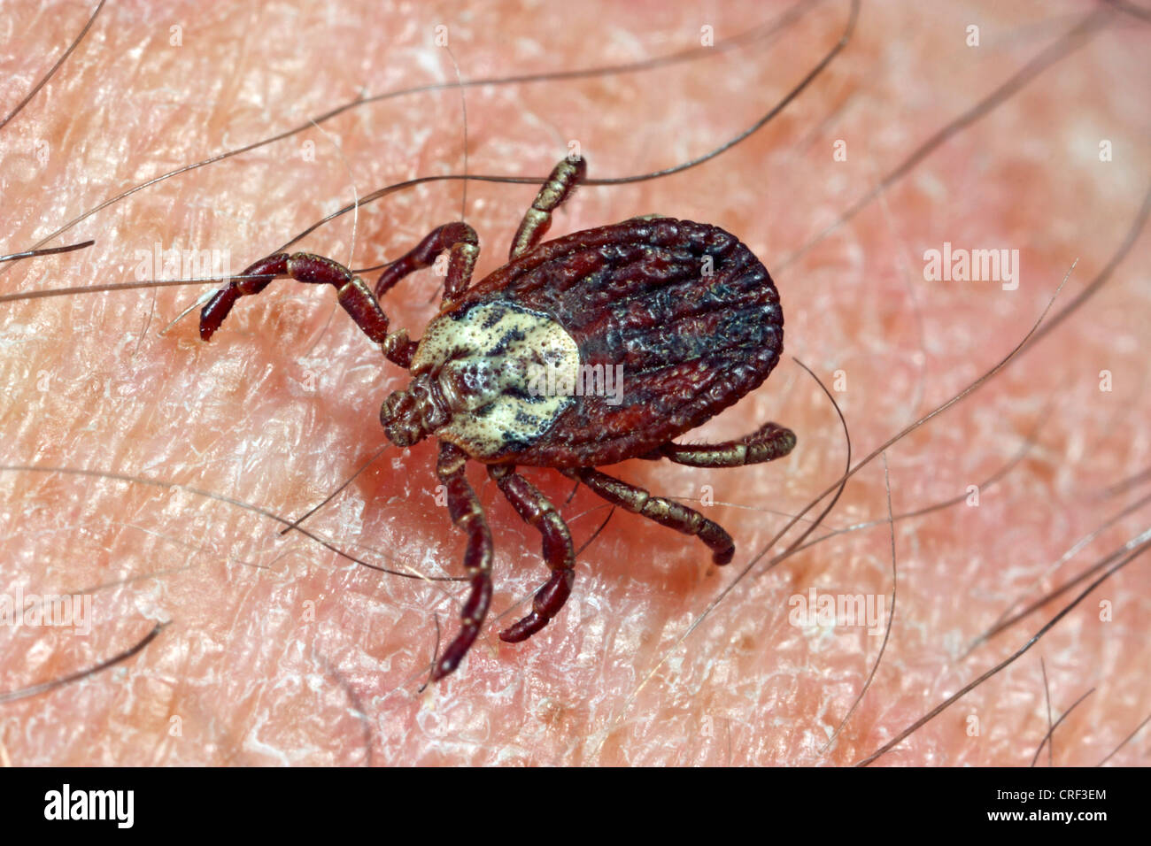 European sheep tick (Dermacentor marginatus), female Stock Photo - Alamy