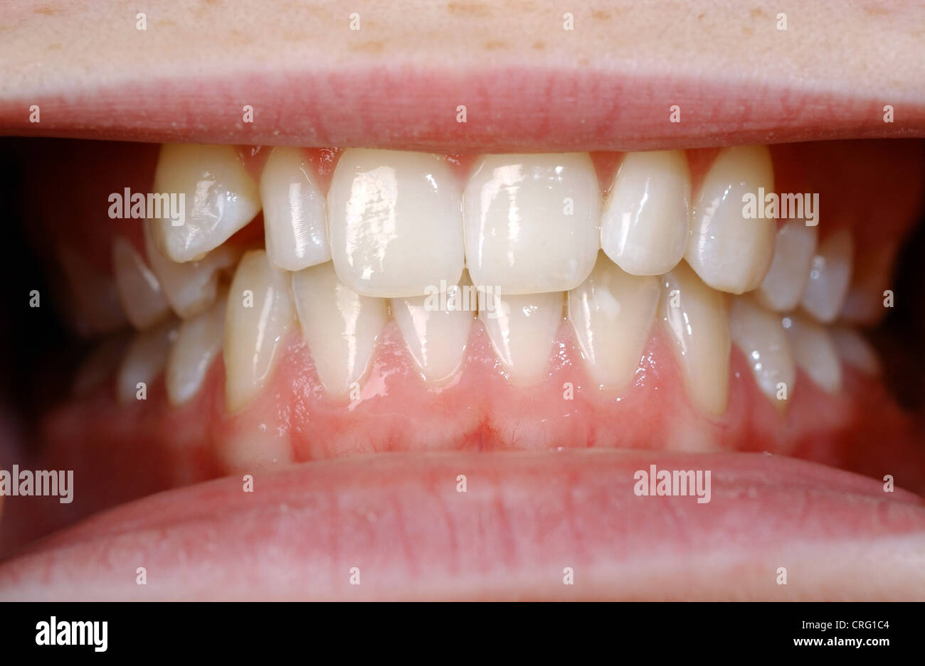 Close-up of a woman's healthy teeth Stock Photo - Alamy