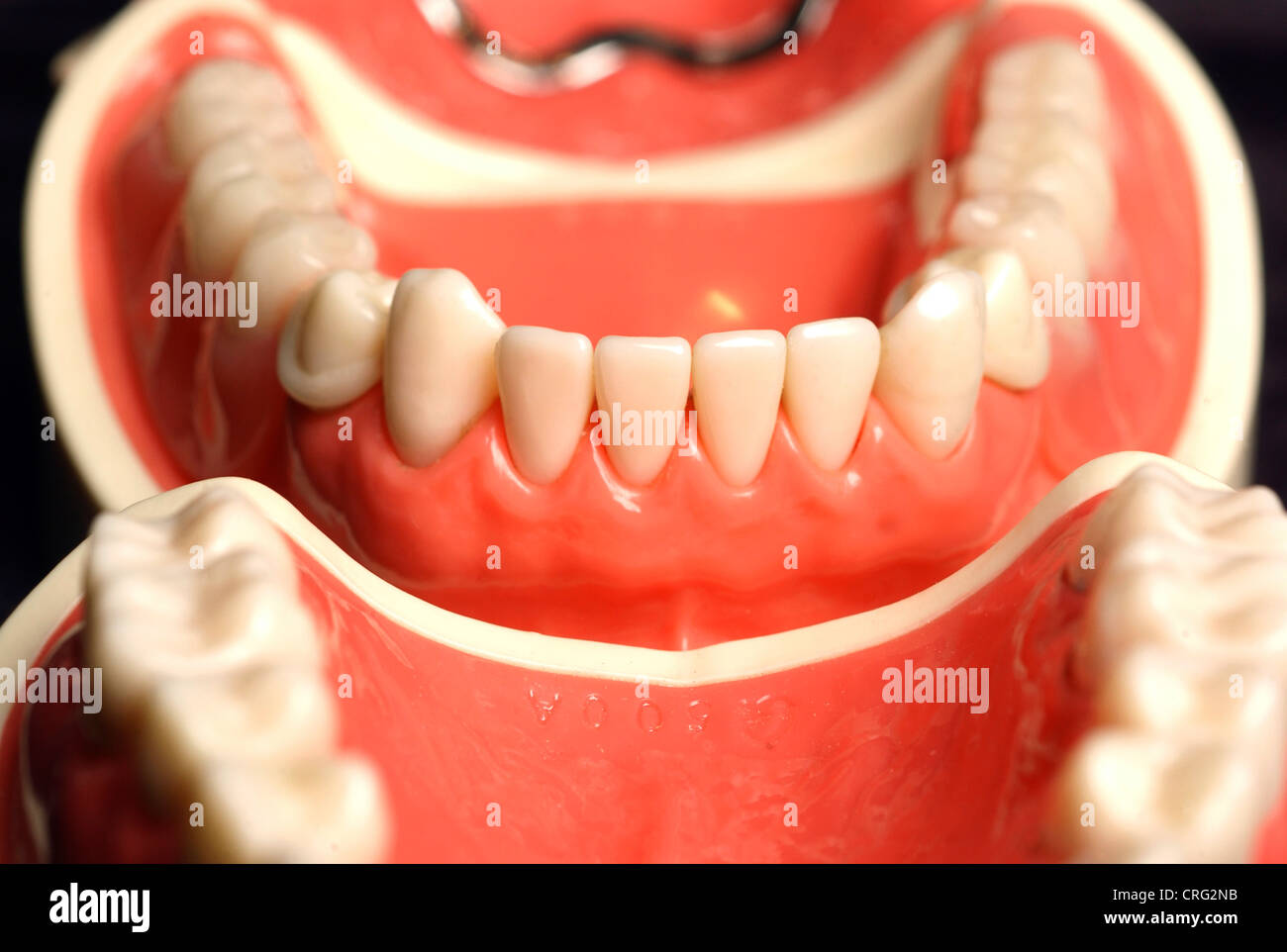 Maxillary denture hi-res stock photography and images - Alamy