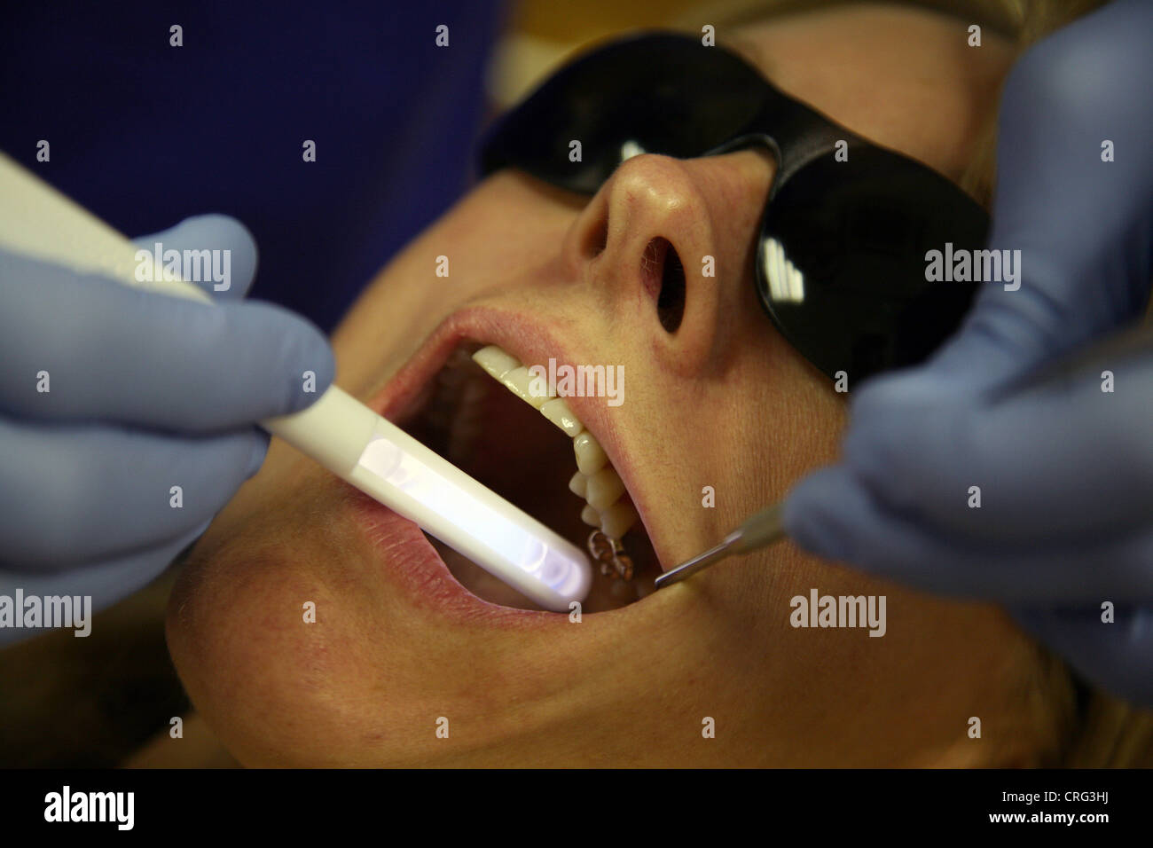 Dentist checking patients teeth Stock Photo - Alamy