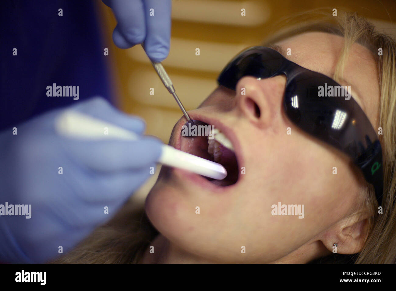 Oral cancer surgery hi-res stock photography and images - Alamy