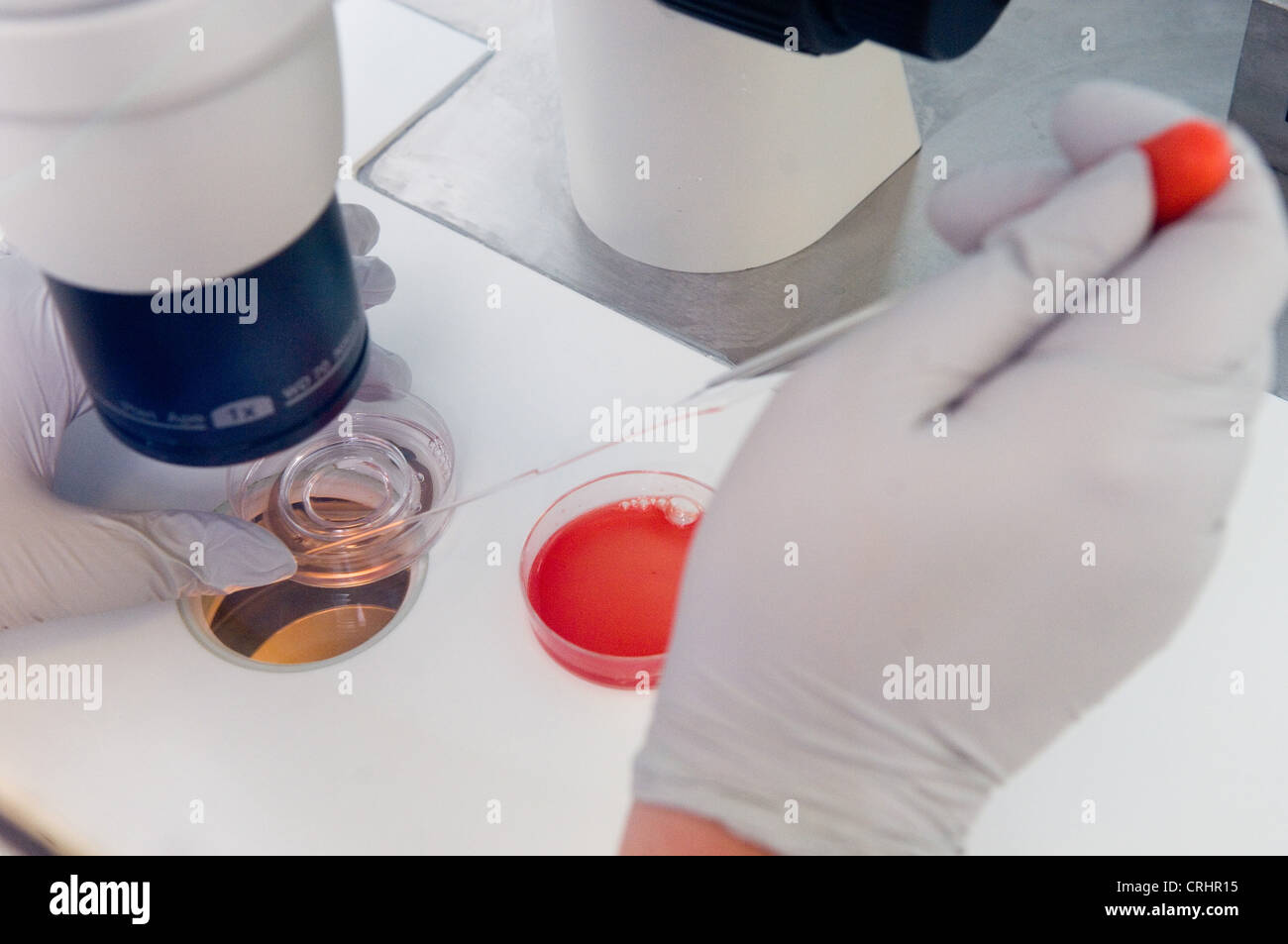 Before implantation and during hormone therapy CT scans are performed ...