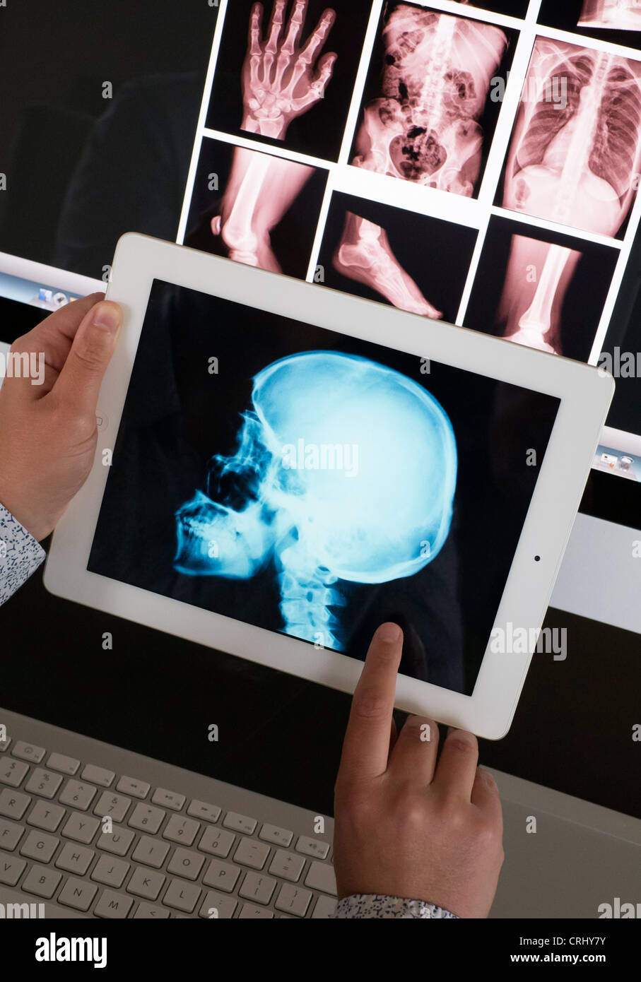 Doctor xray hi-res stock photography and images - Alamy