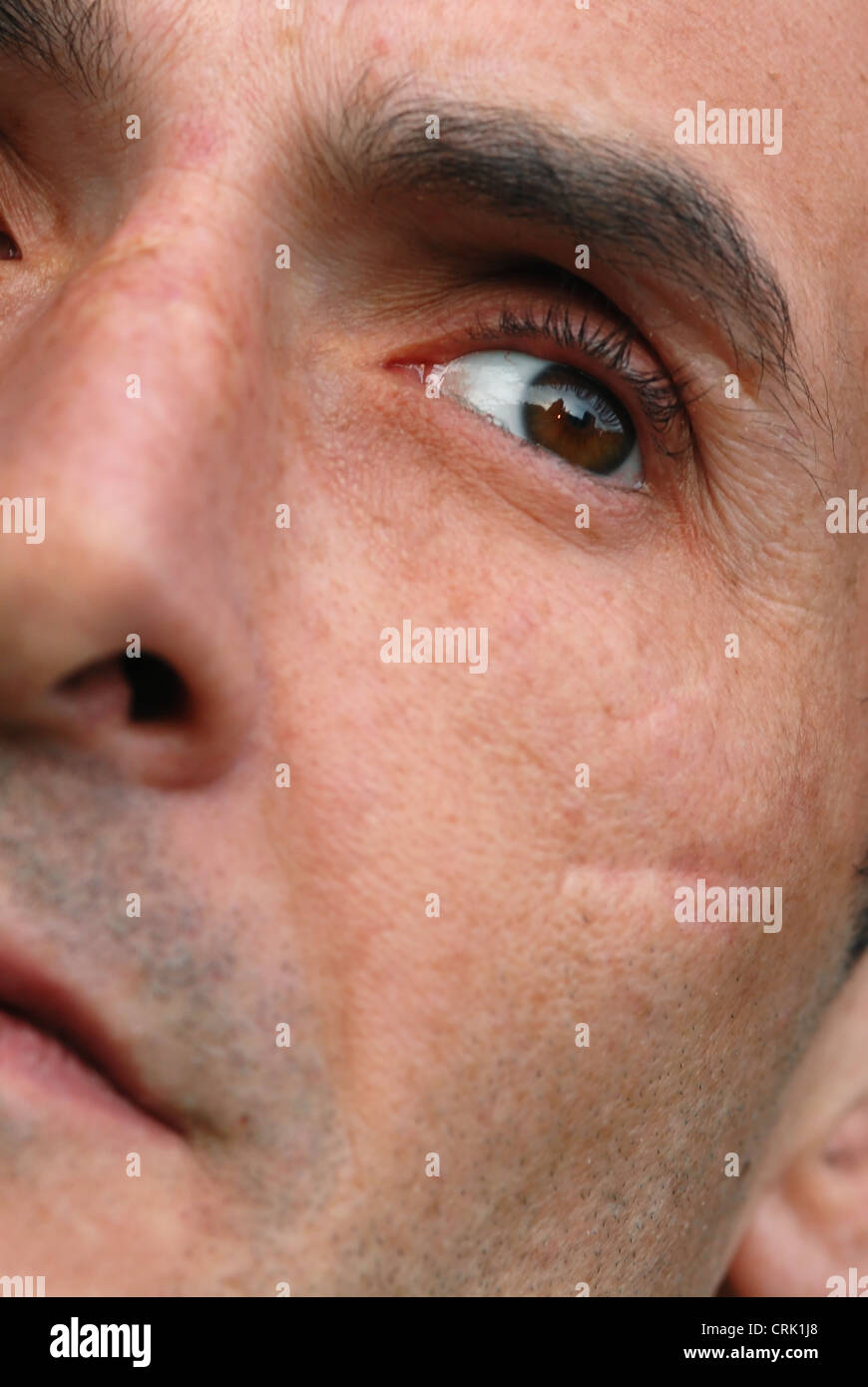 Facial scar hi-res stock photography and images - Alamy