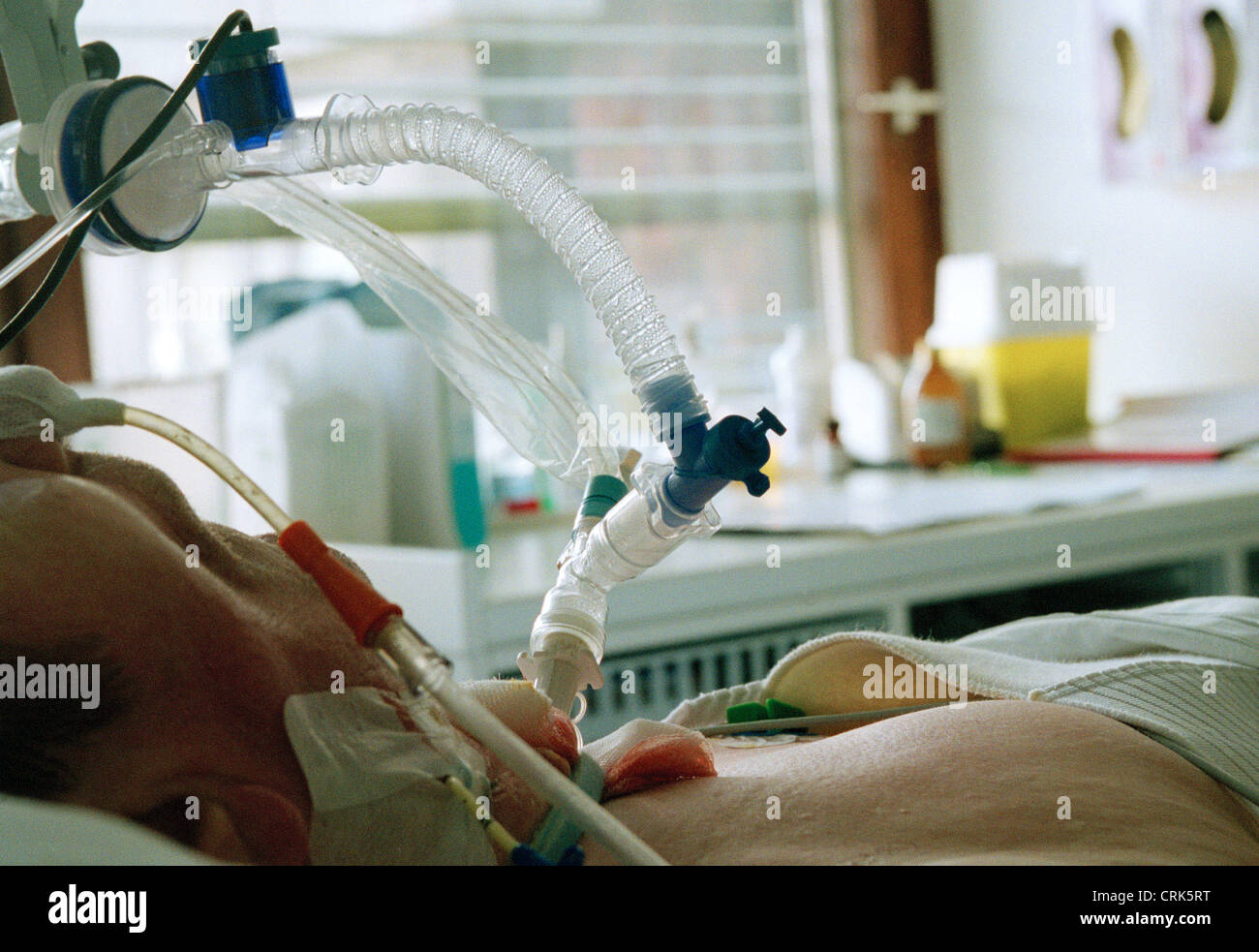 Sick man in icu hi-res stock photography and images - Alamy