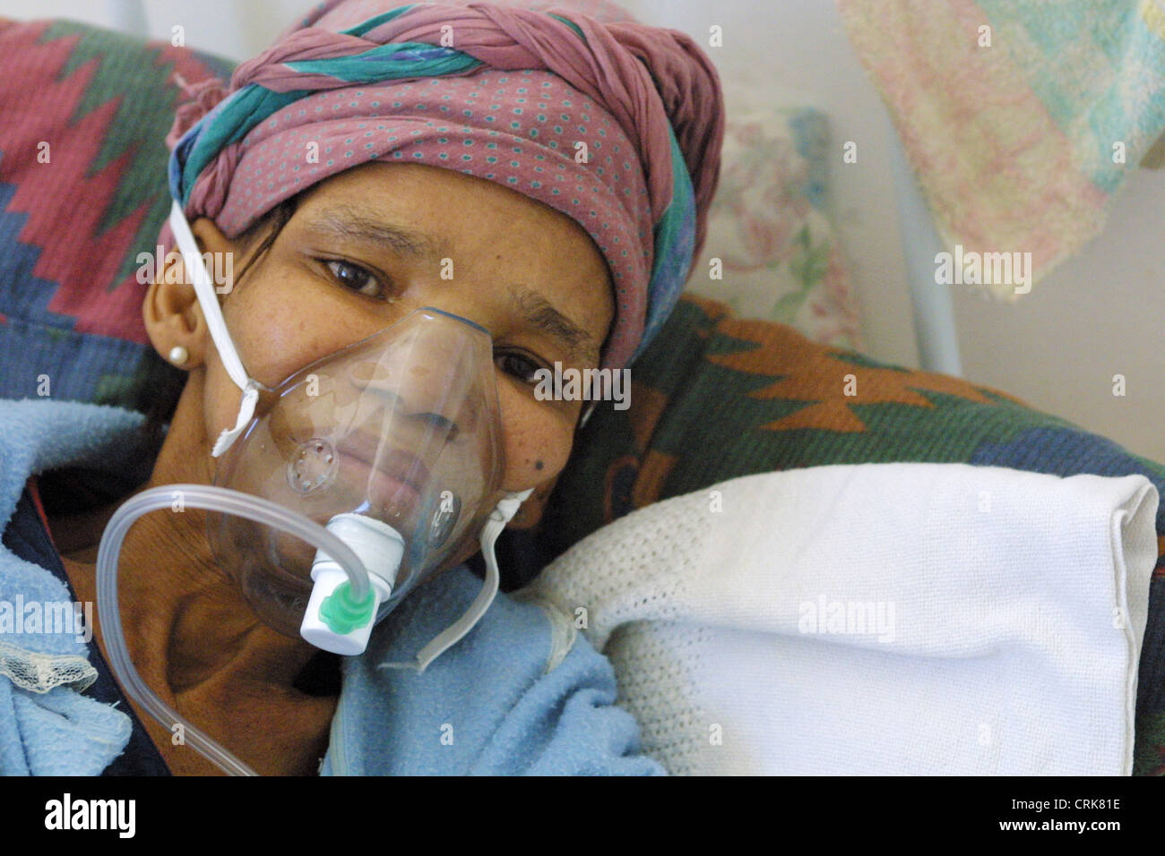 Tuberculosis patients in Namibia Stock Photo - Alamy