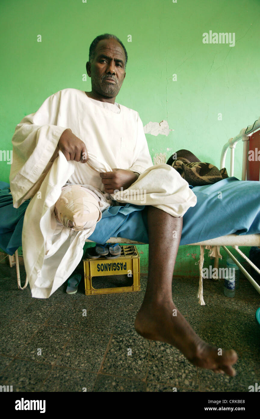 Lower limb amputation hi-res stock photography and images - Alamy