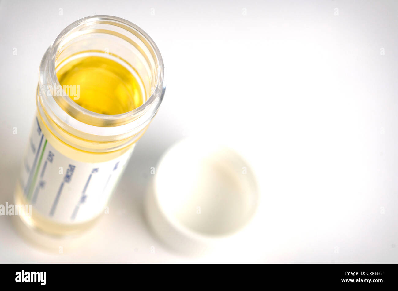urine test sample Stock Photo - Alamy