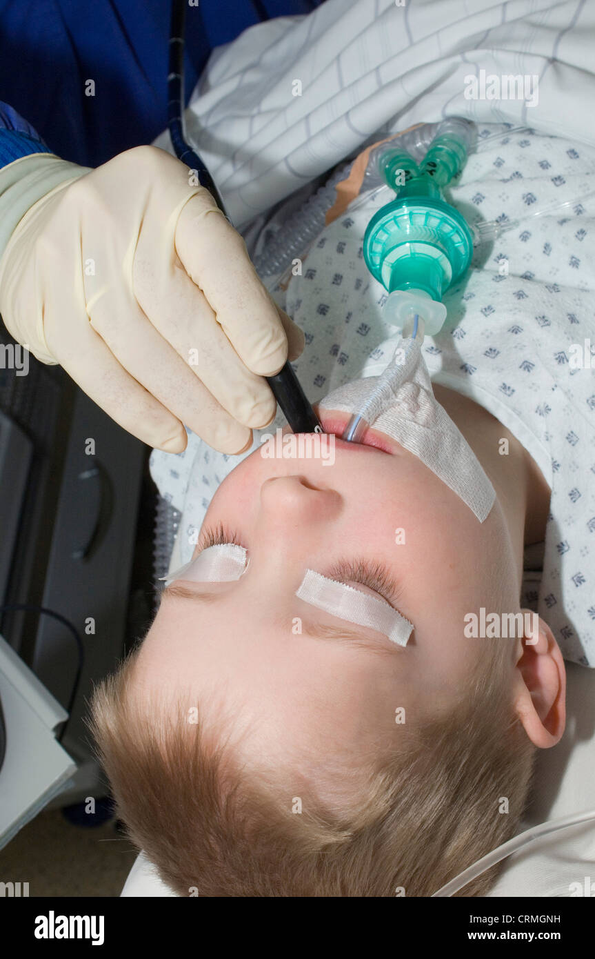 A young boy undergoing an endoscopic procedure Stock Photo - Alamy