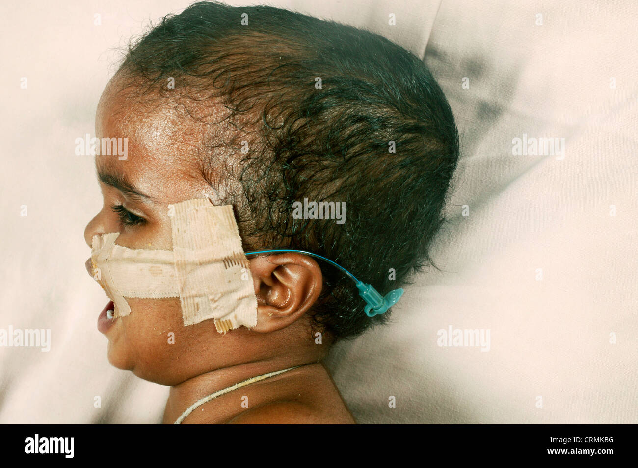 small baby in hospital bed very ill Stock Photo - Alamy