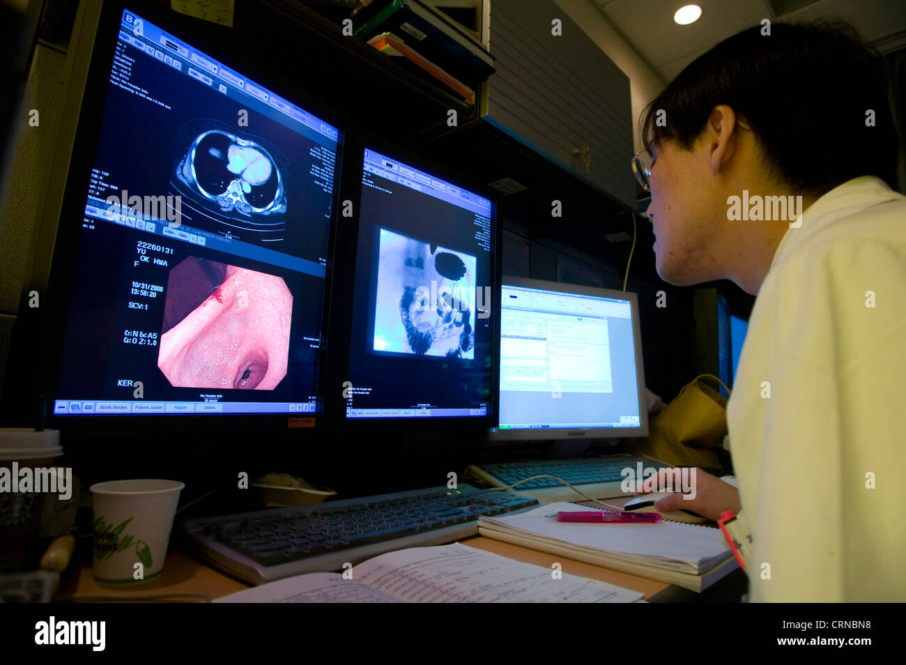 Endoscopic images hi-res stock photography and images - Alamy