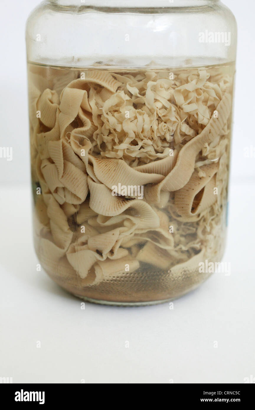 Bilharzia hi-res stock photography and images - Alamy