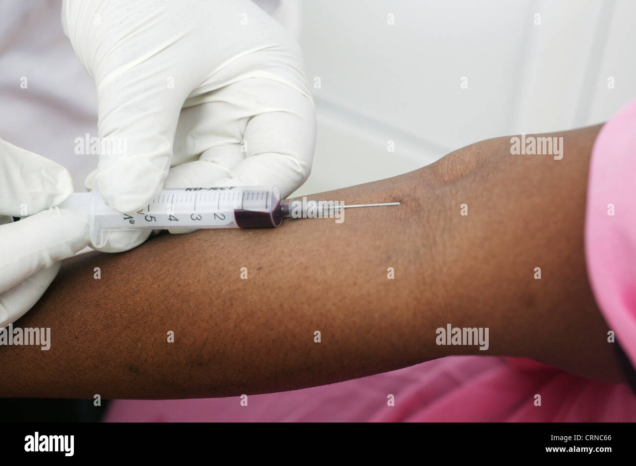 A nurse inserts a needle to draw blood from a patients arm Stock Photo ...