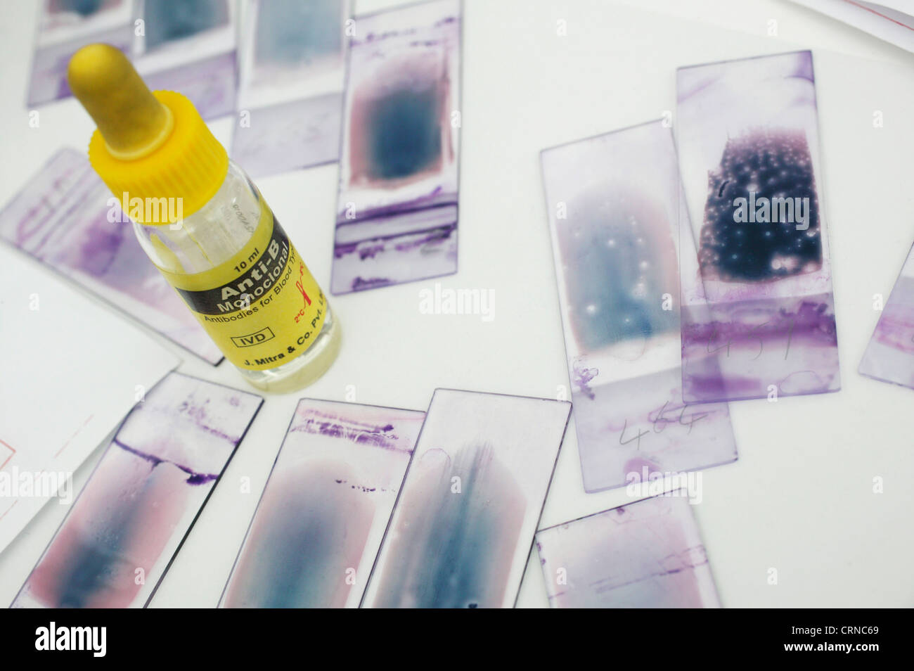 Haematology slides hi-res stock photography and images - Alamy