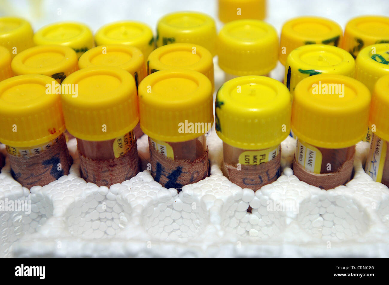 An array of vials used to store specimen for testing Stock Photo - Alamy