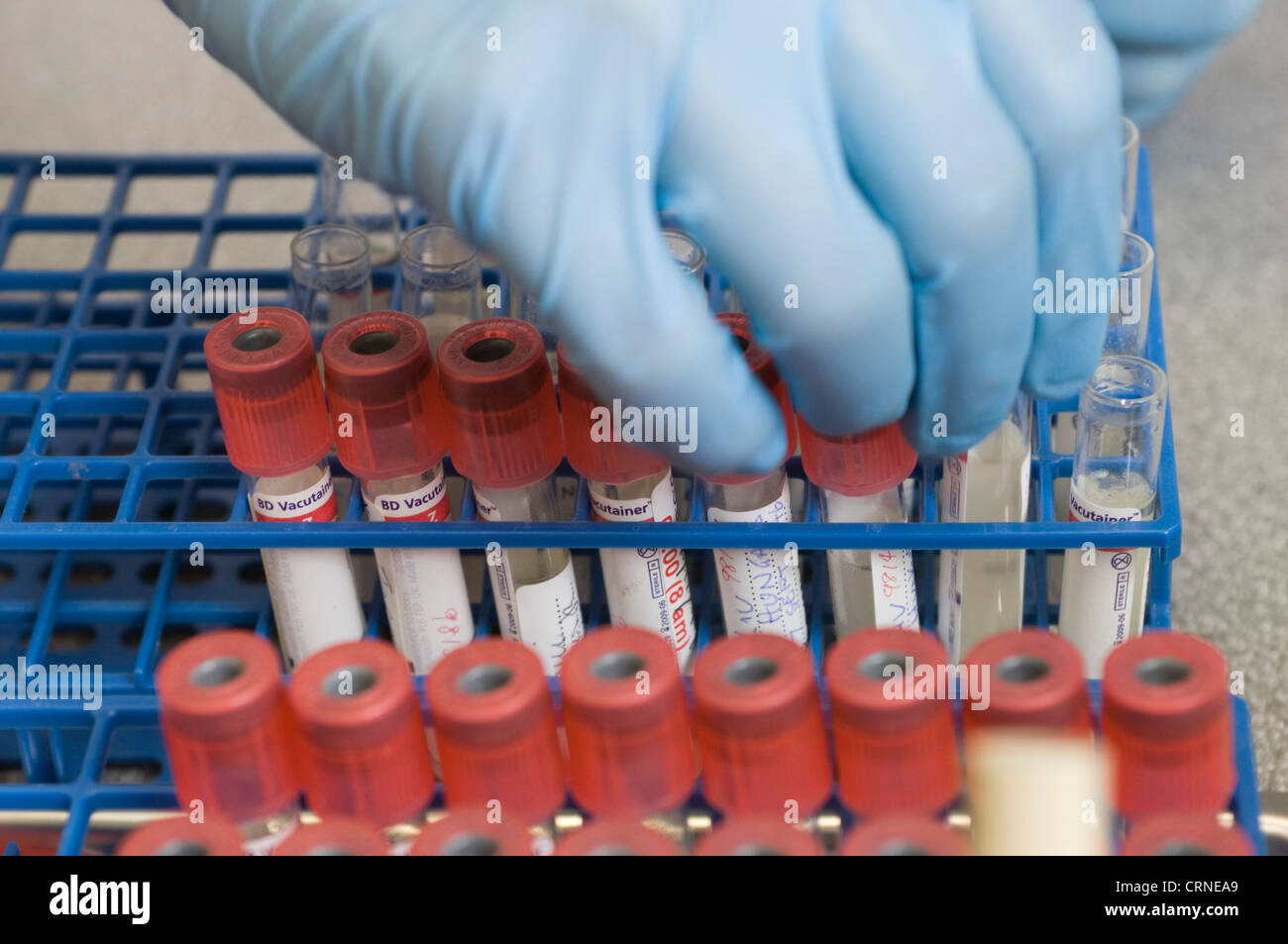 A sample is chosen for testing Stock Photo - Alamy