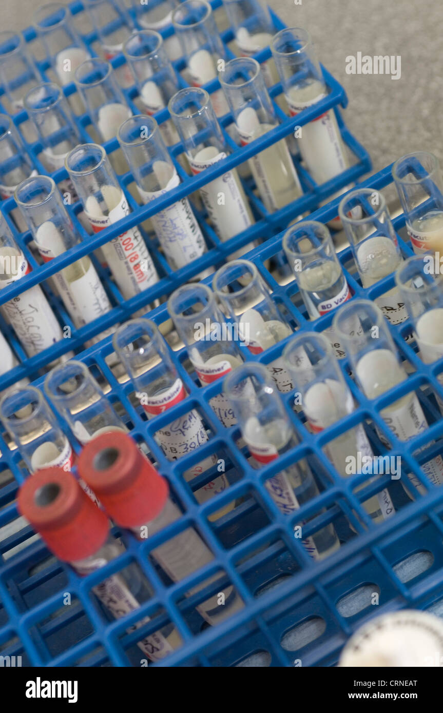 Via Connecting Tube Vials
