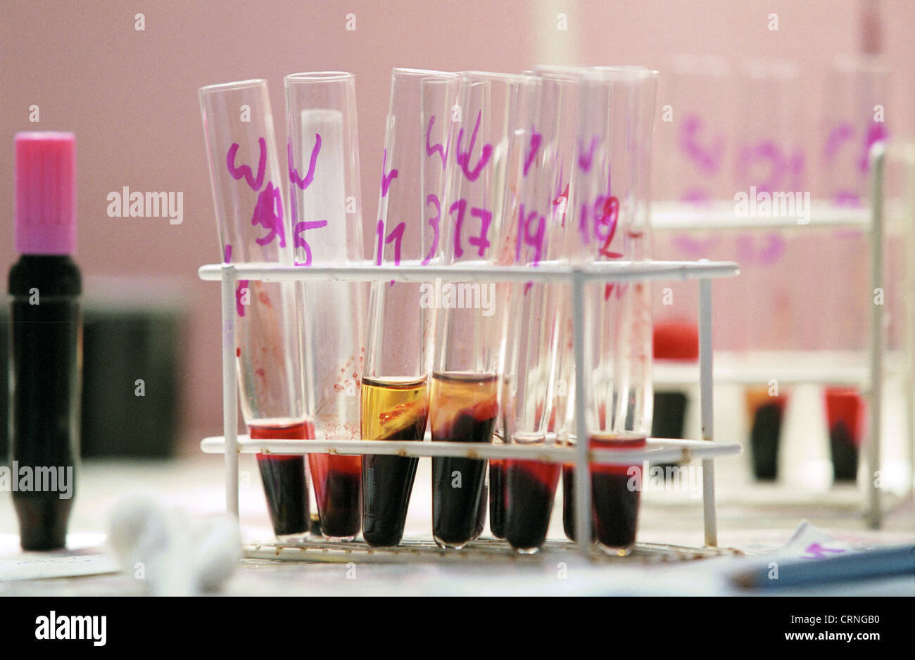 Blood samples in a test tube Stock Photo - Alamy