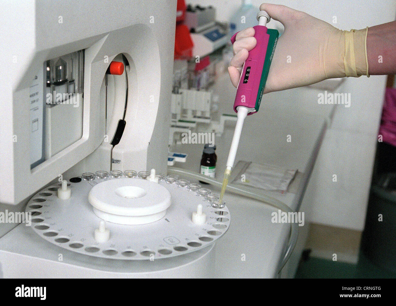 Pipetting of fluids in a hospital laboratory Stock Photo - Alamy