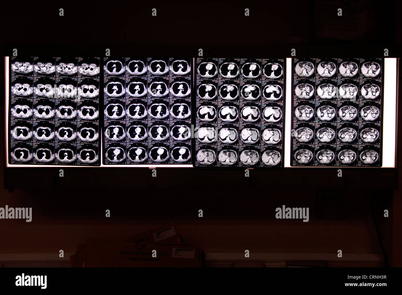 selection cat scans Stock Photo - Alamy