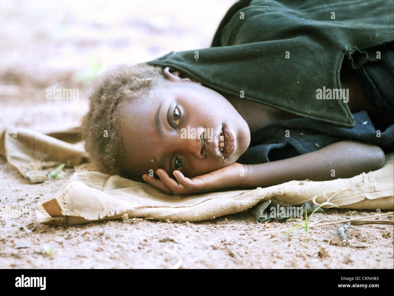 Undernourished child hi-res stock photography and images - Alamy