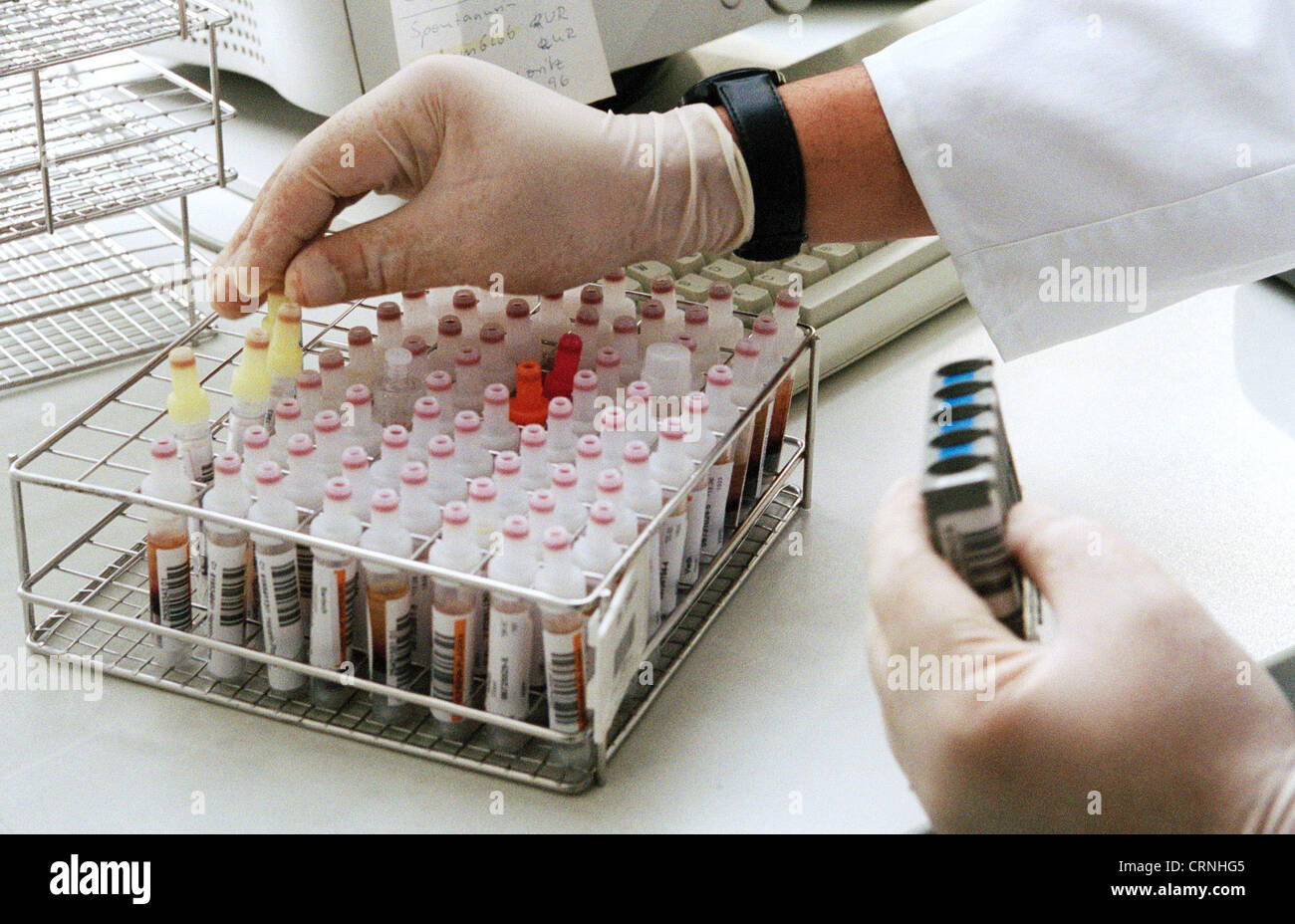 Distributing laboratory samples on racks for the analyzes Stock Photo ...