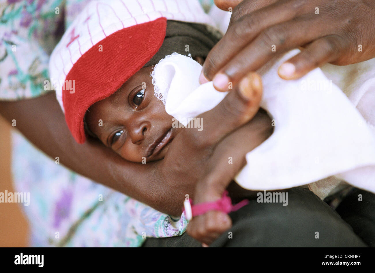 Refugee children africa malnutrition hi-res stock photography and ...
