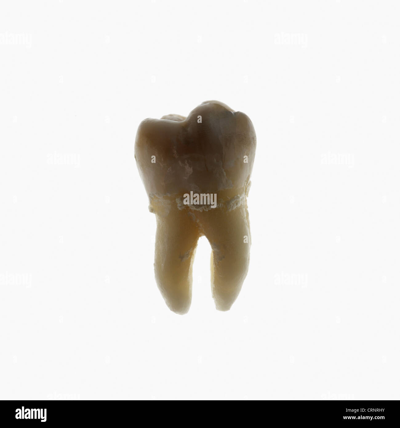Teeth single caries decay cavity white background pull pulled ...