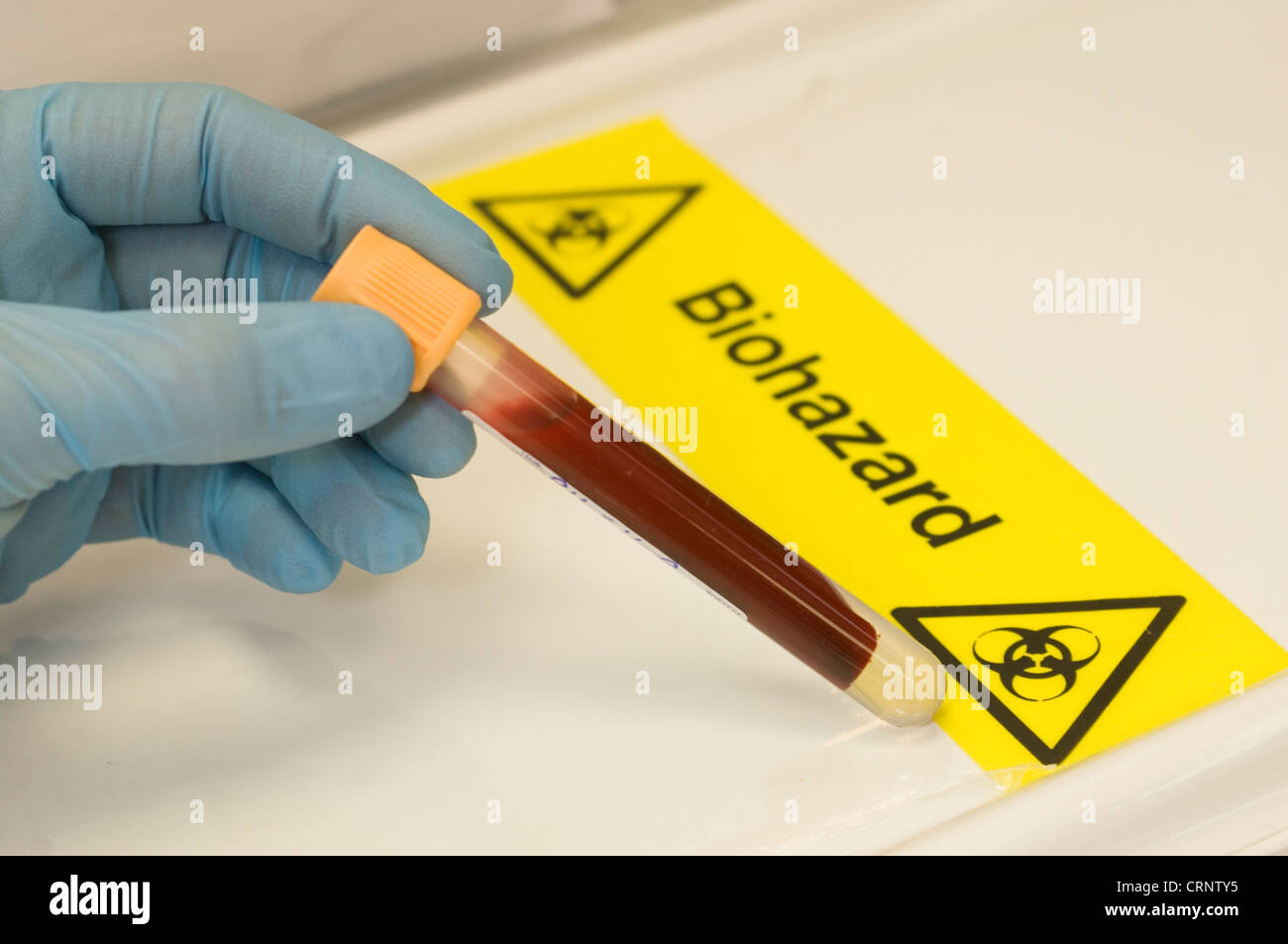 GPs send blood samples into the lab for testing. Samples must be tested ...