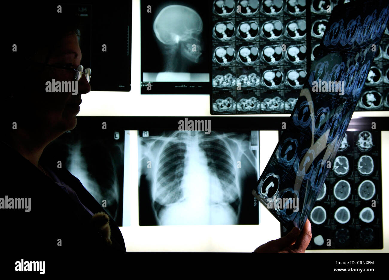 X ray images hi-res stock photography and images - Alamy