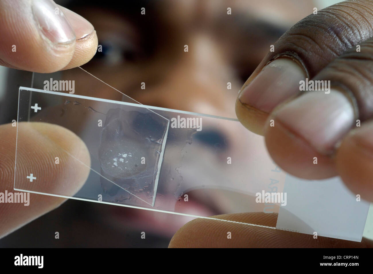 Laboratory specimen hi-res stock photography and images - Alamy