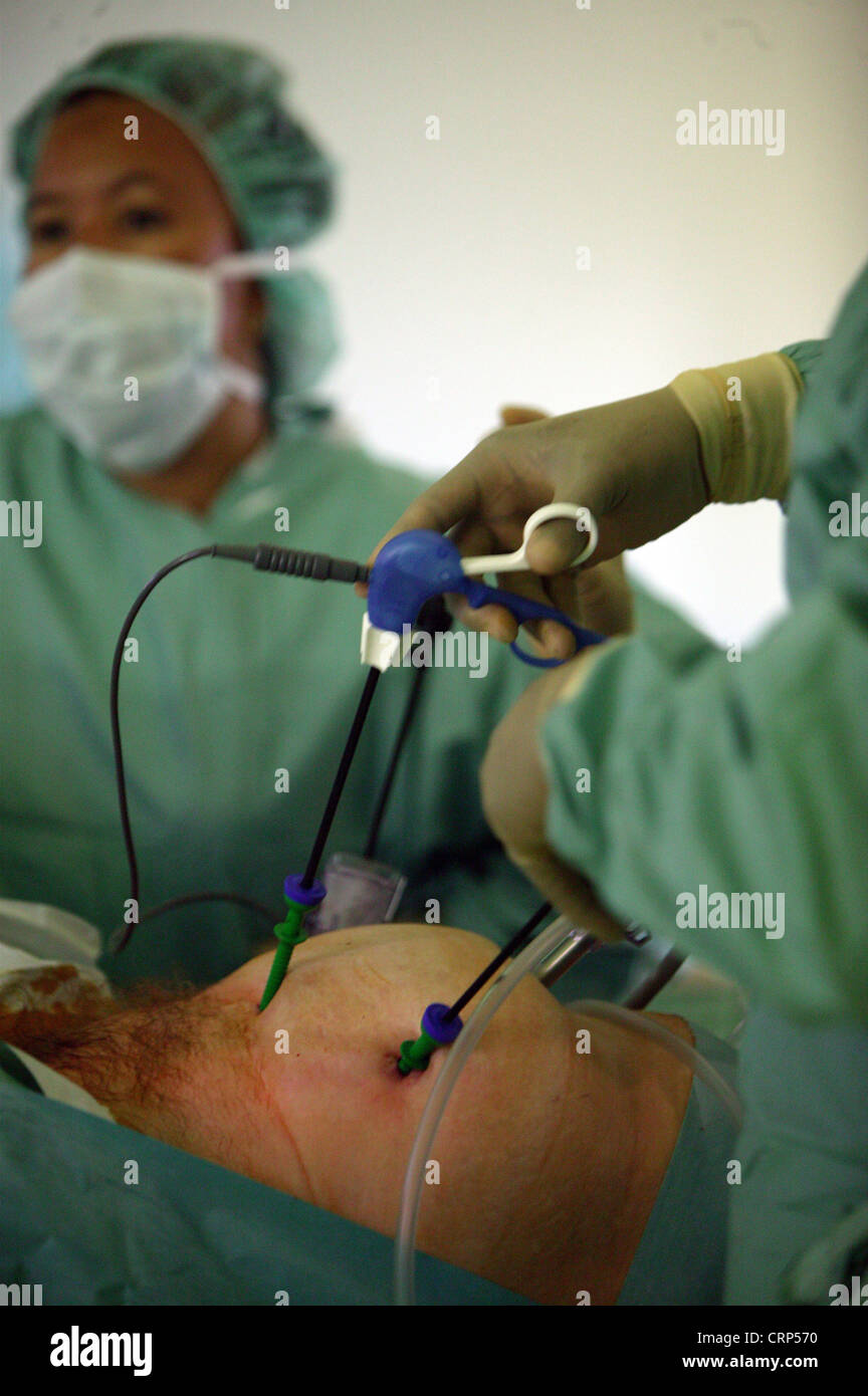 Surgeons perform a Laparoscopic Sacrocolpopexy (The correction of ...