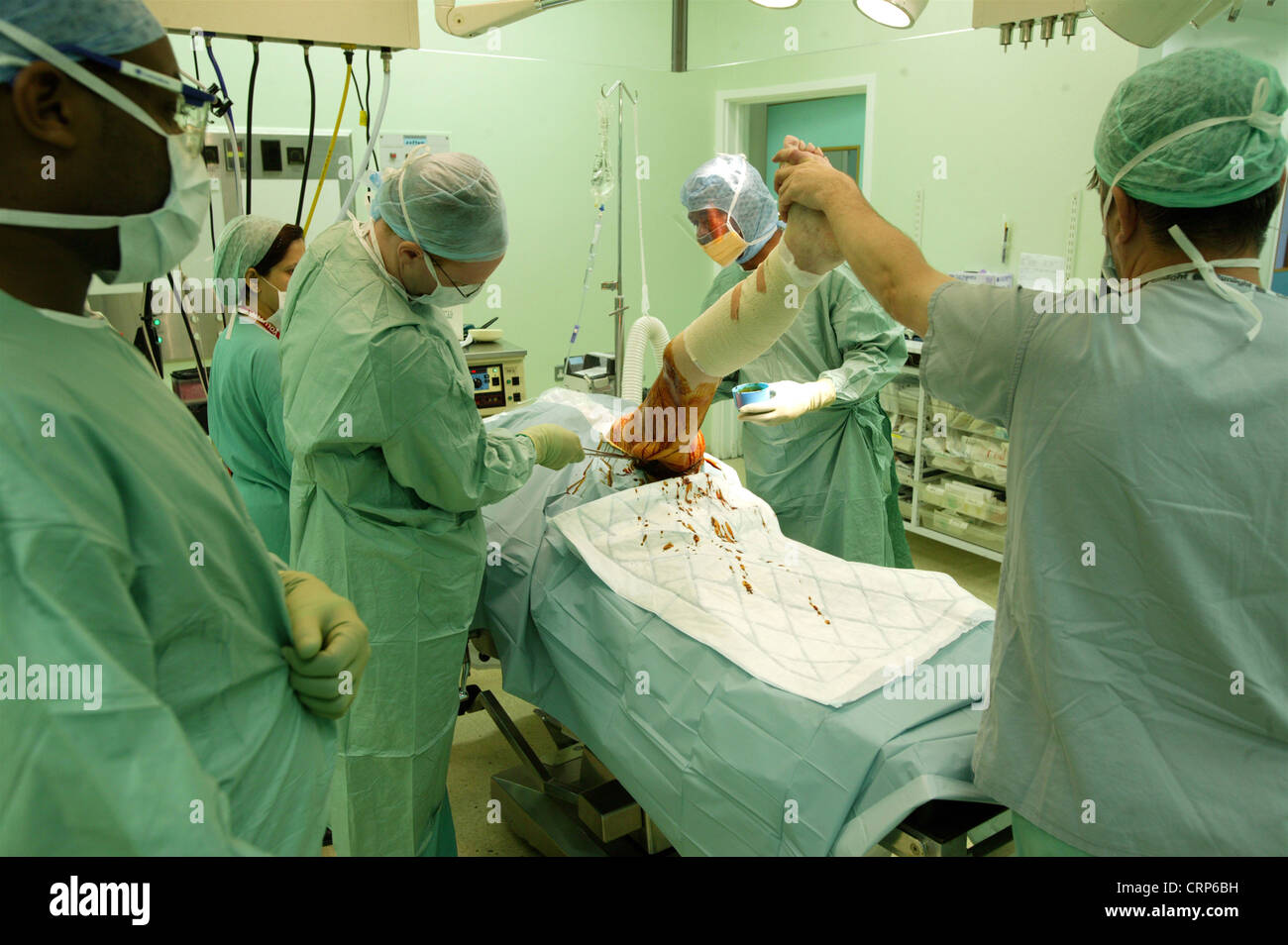 nurse holds up the patients leg during an operation Stock Photo - Alamy