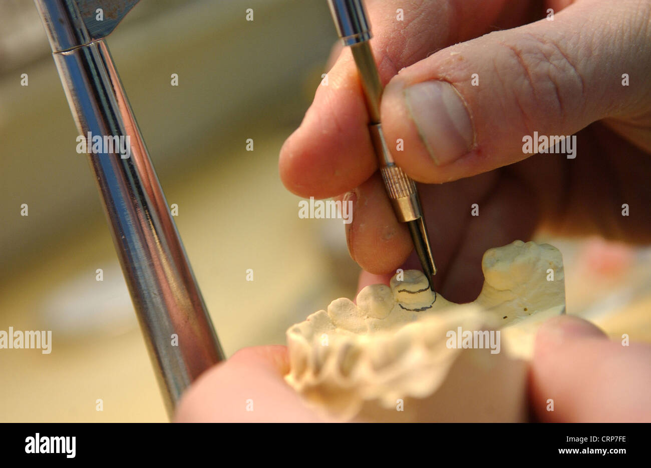 Marking out a dental cast in initial preparation for making a denture ...