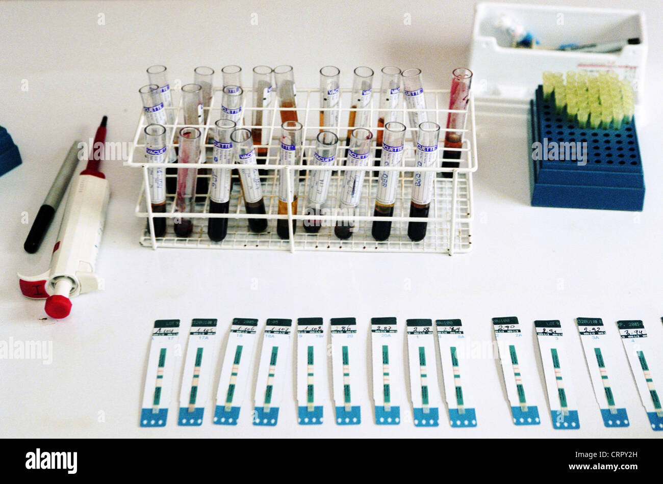 Positive aids test strip hi-res stock photography and images - Alamy