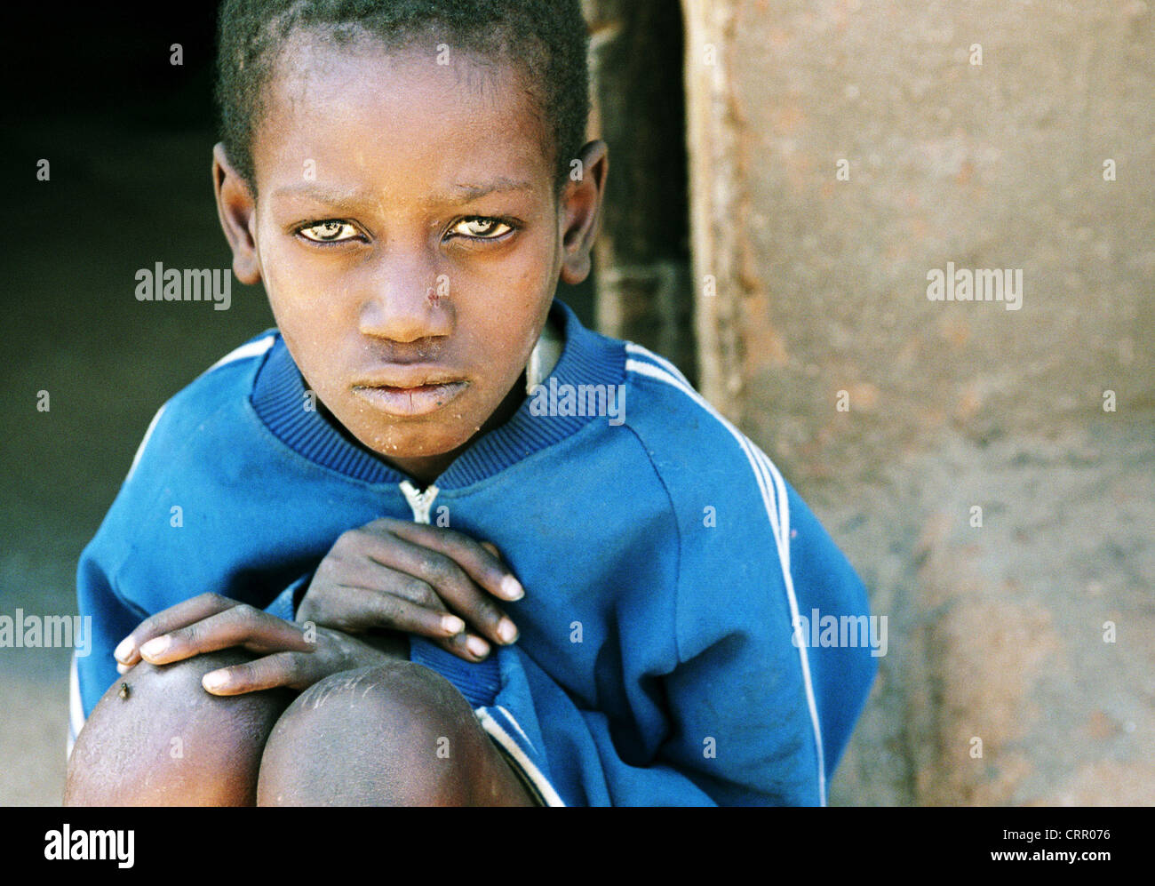 Portrait of a young AIDS patient Stock Photo - Alamy