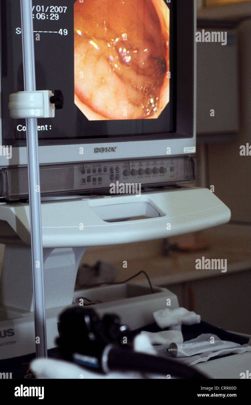 Endoscopic procedure on a monitor screen Stock Photo - Alamy