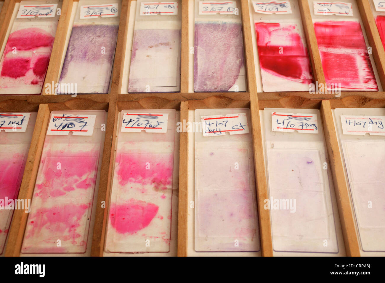 Body Cavity High Resolution Stock Photography and Images - Alamy