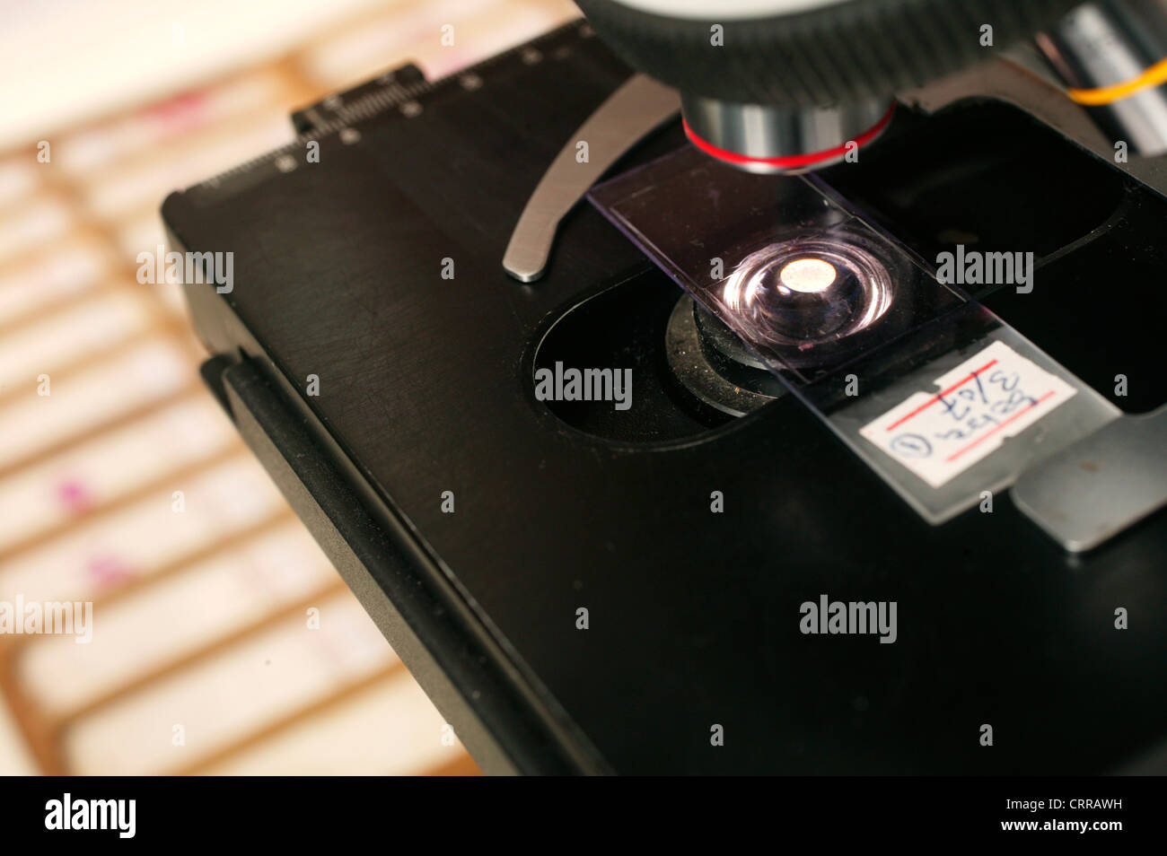 Cytology slide hi-res stock photography and images - Alamy