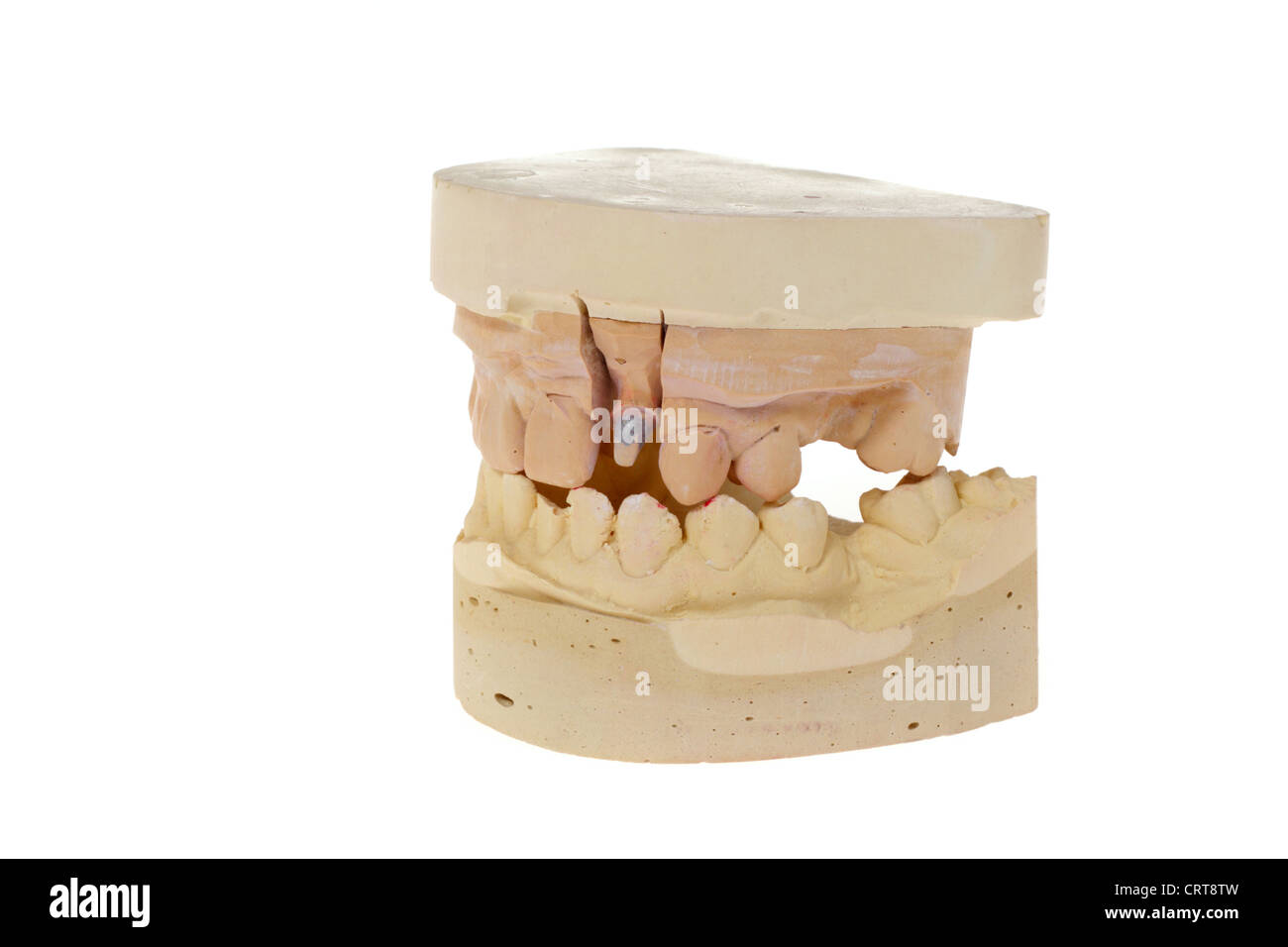 Cast of the jaw photo on the white background Stock Photo - Alamy