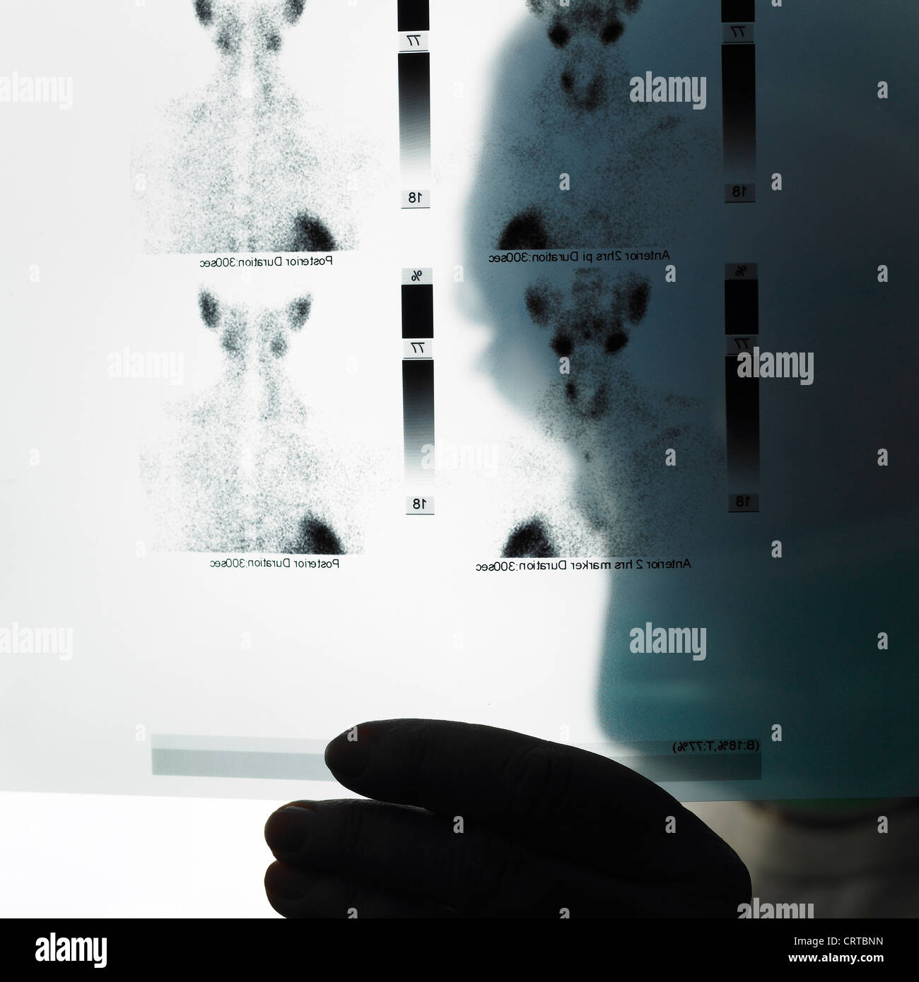 Medical Scans High Resolution Stock Photography and Images - Alamy