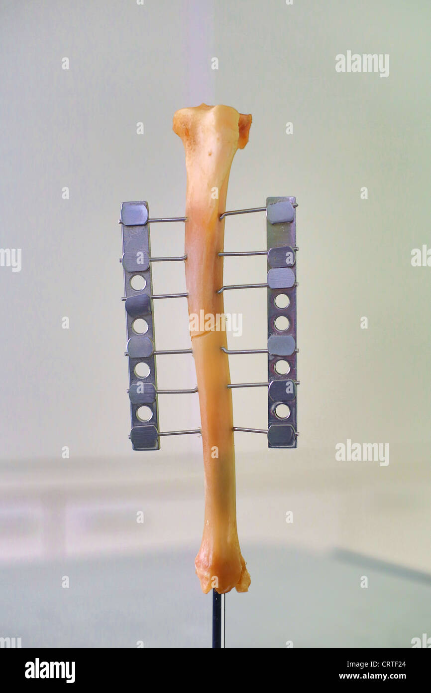 Human bone marrow anatomy hi-res stock photography and images - Alamy