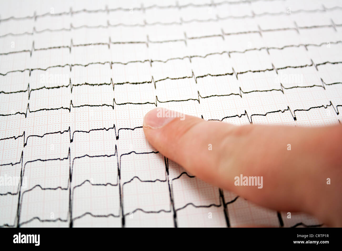 Doctor analyzing ECG - EKG graph Stock Photo - Alamy