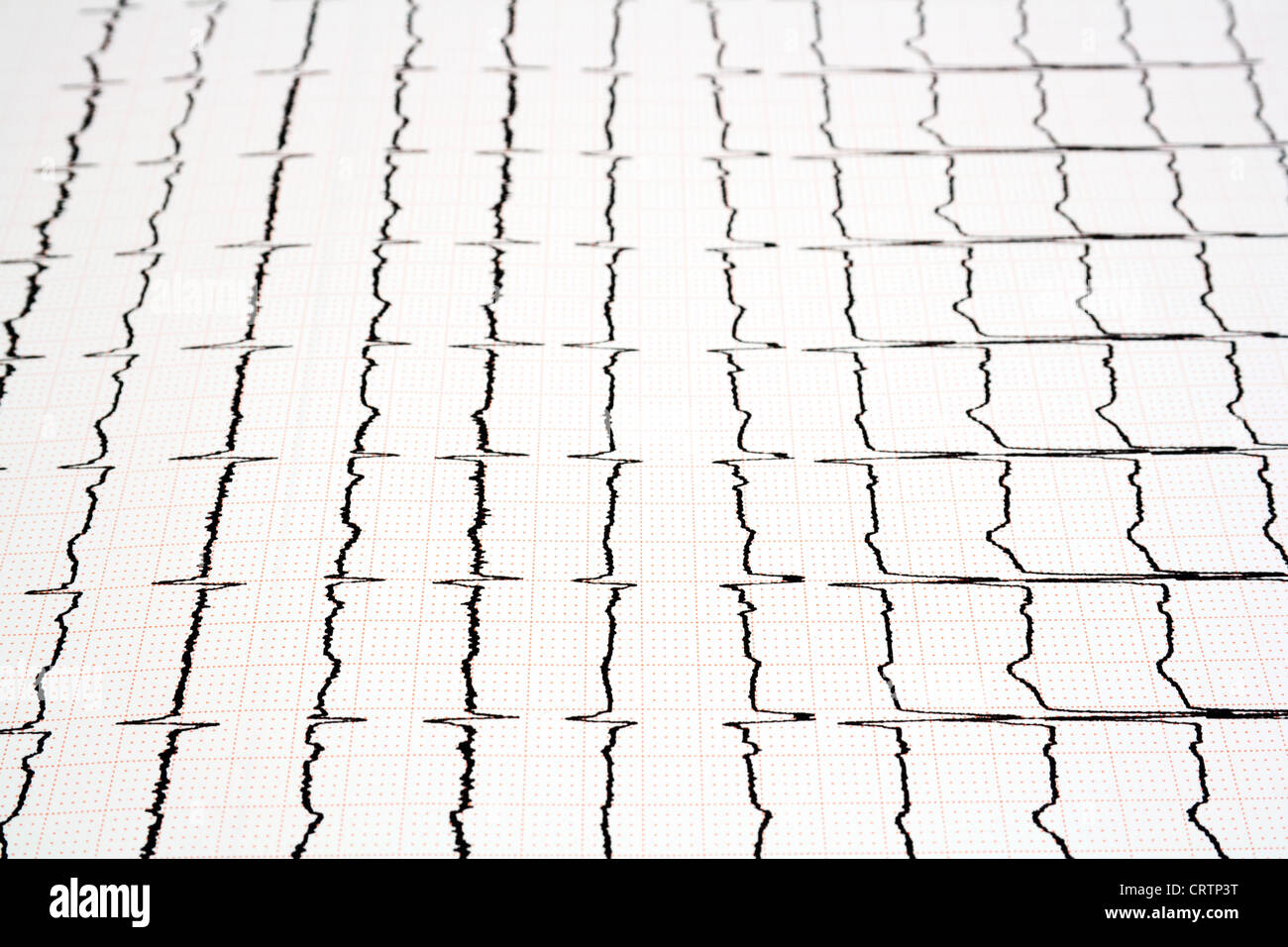 Close-up image of ECG - EKG graph Stock Photo - Alamy