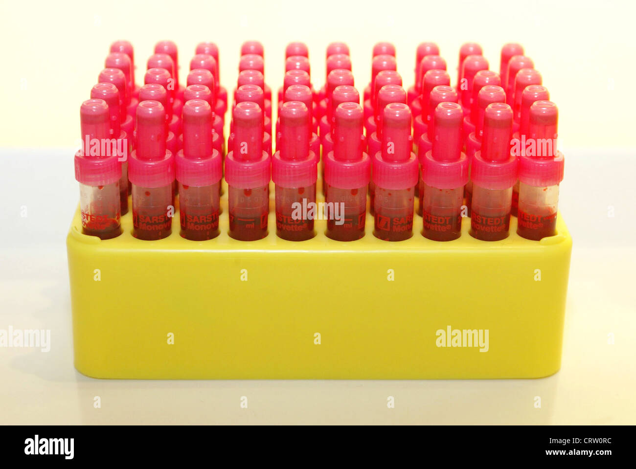 Sarstedt Monovette Blood Collection Tubes at Jade Stainforth blog