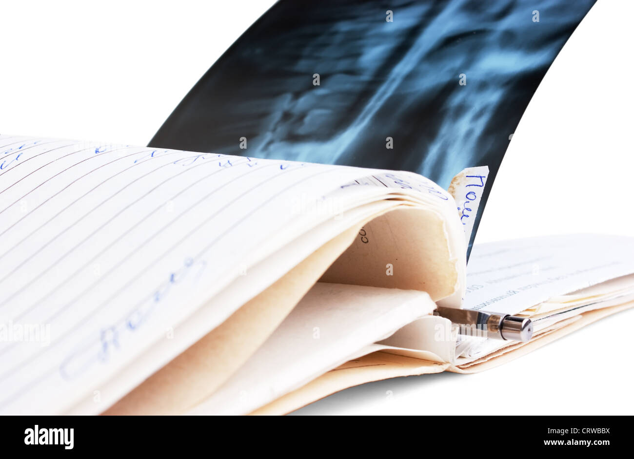 open medical history and x-ray Stock Photo - Alamy