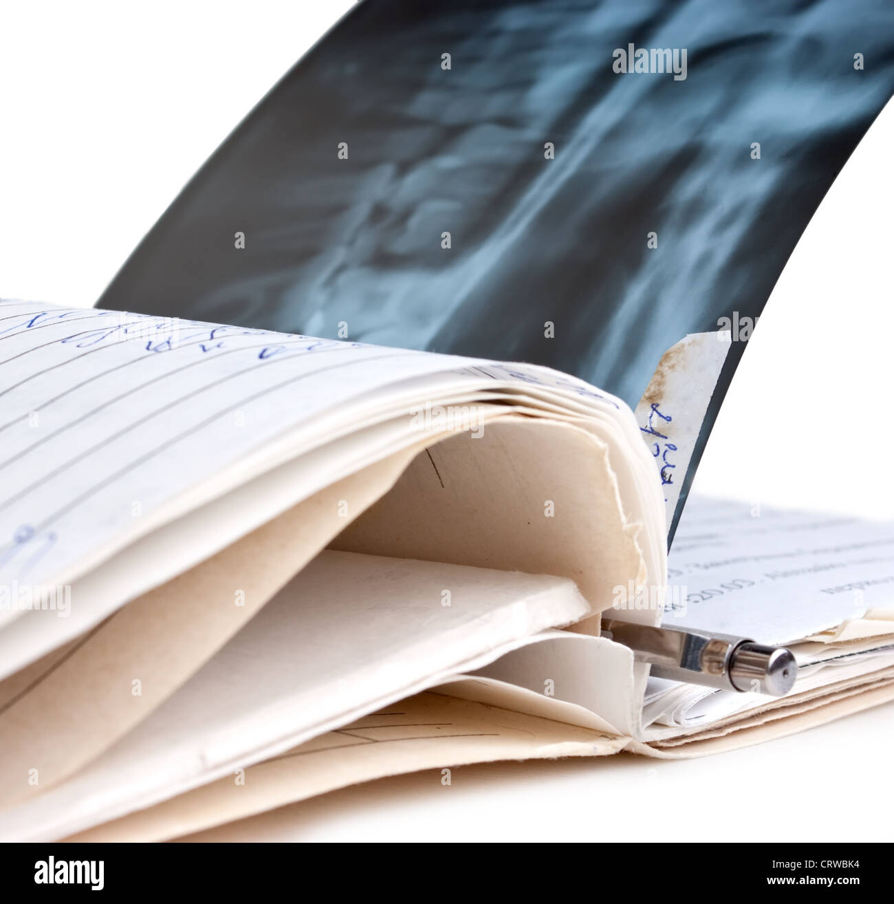 open medical history and x-ray Stock Photo - Alamy